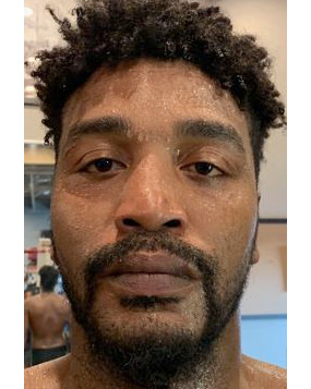 Craig Lewis - BoxRec